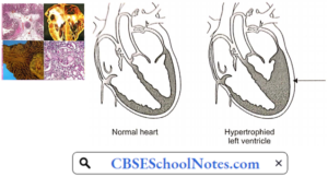 Cell injury and Cellular Adaptation Notes - CBSE School Notes