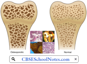 Pathophysiology Archives - CBSE School Notes